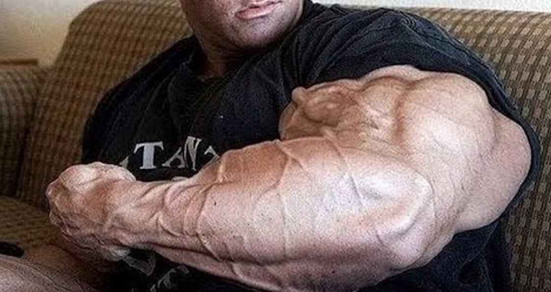 Massive Bicep Flex
