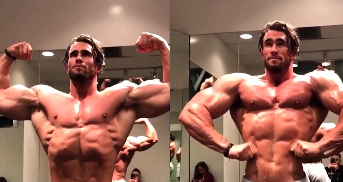 Calum Von Moger Starts Physical Therapy Ready For A Big Comeback In