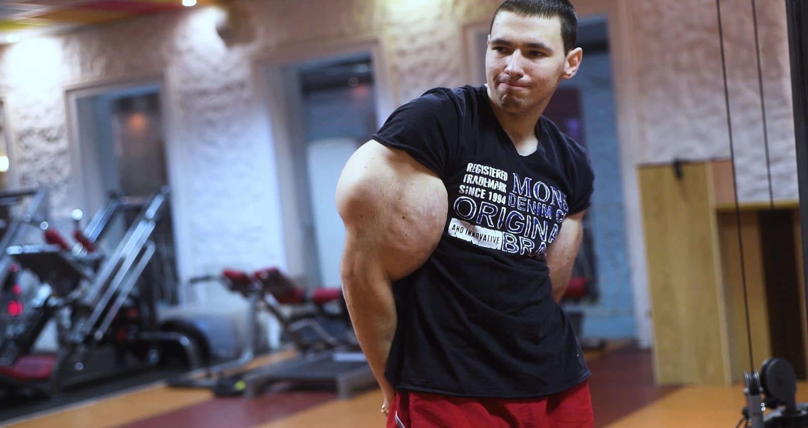 Kirill Tereshin Risks Death If Jelly Is Not Removed From Biceps