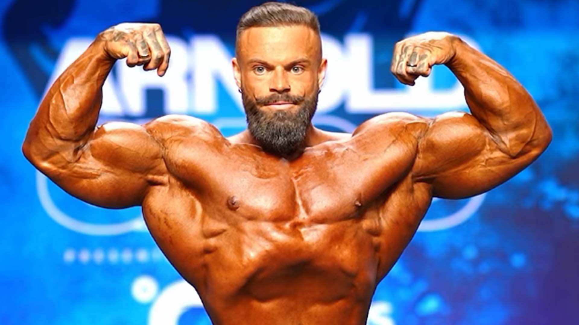 Mike Sommerfeld Drops 14 Pounds & Is Cleared to Compete at 2025 Olympia ...