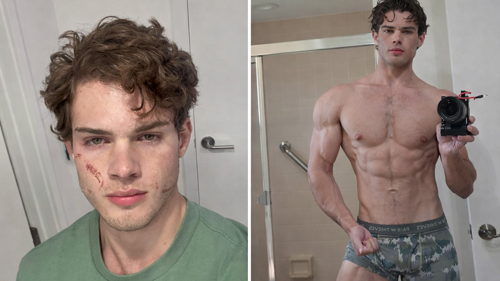 Looksmaxxing Influencer Clavicular Hospitalized After Suspected ...